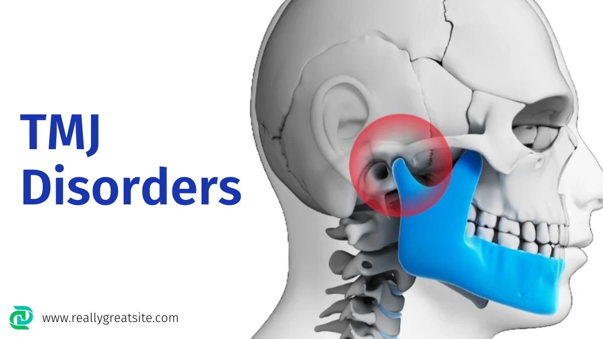 Understanding Tmj Issues Comprehensive Guide 2024